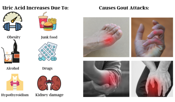 Why high Uric acid and how to manage Naturally ? - Wellness By Rosh ...